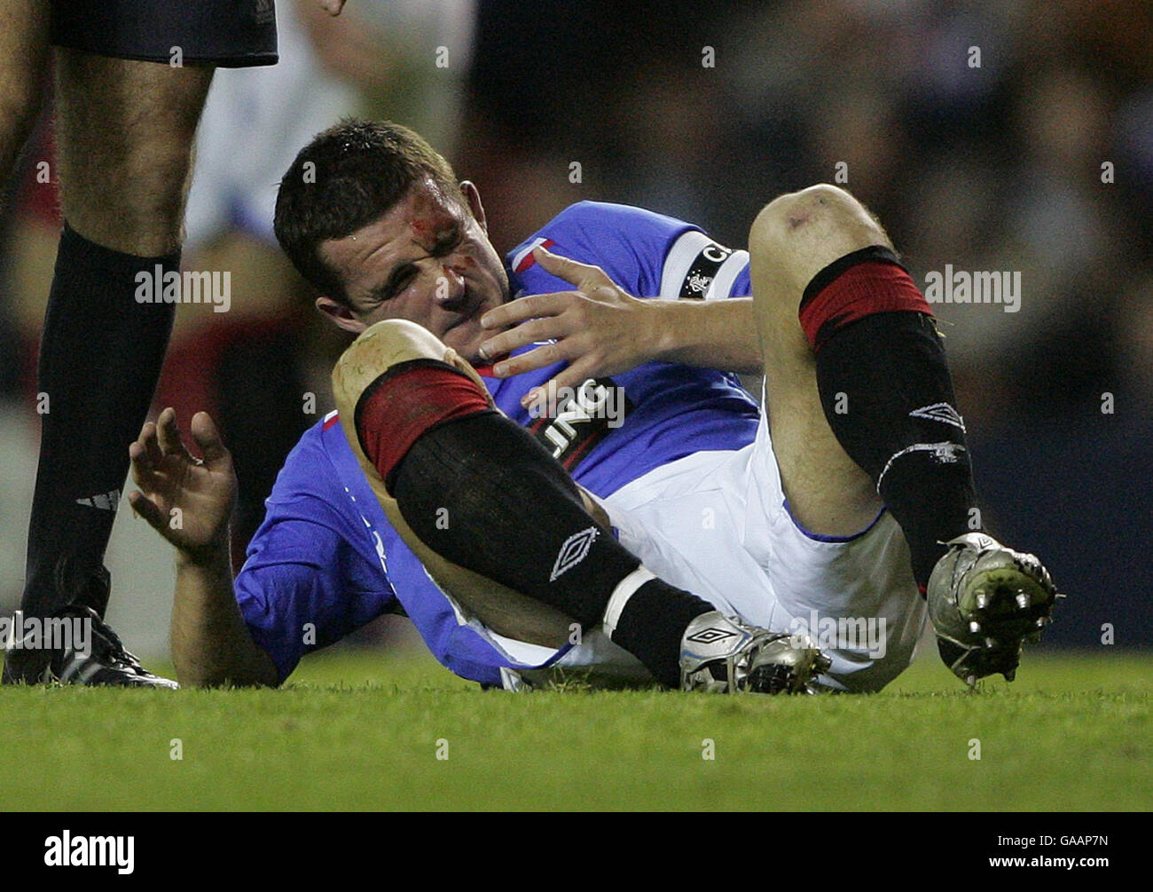 Soccer football blood bleeding hi-res stock photography and images - Alamy