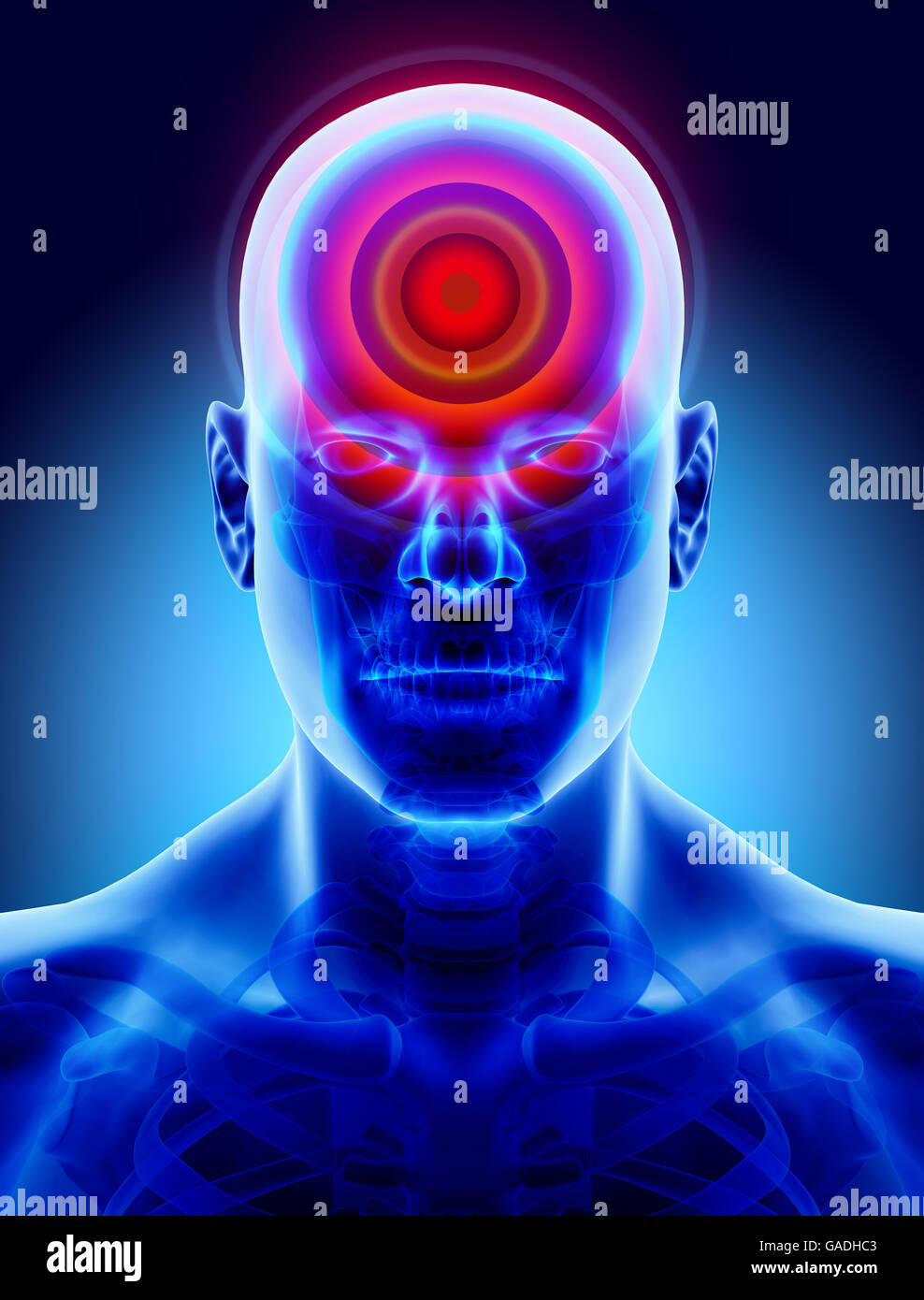 Brain pain signal hi-res stock photography and images - Alamy