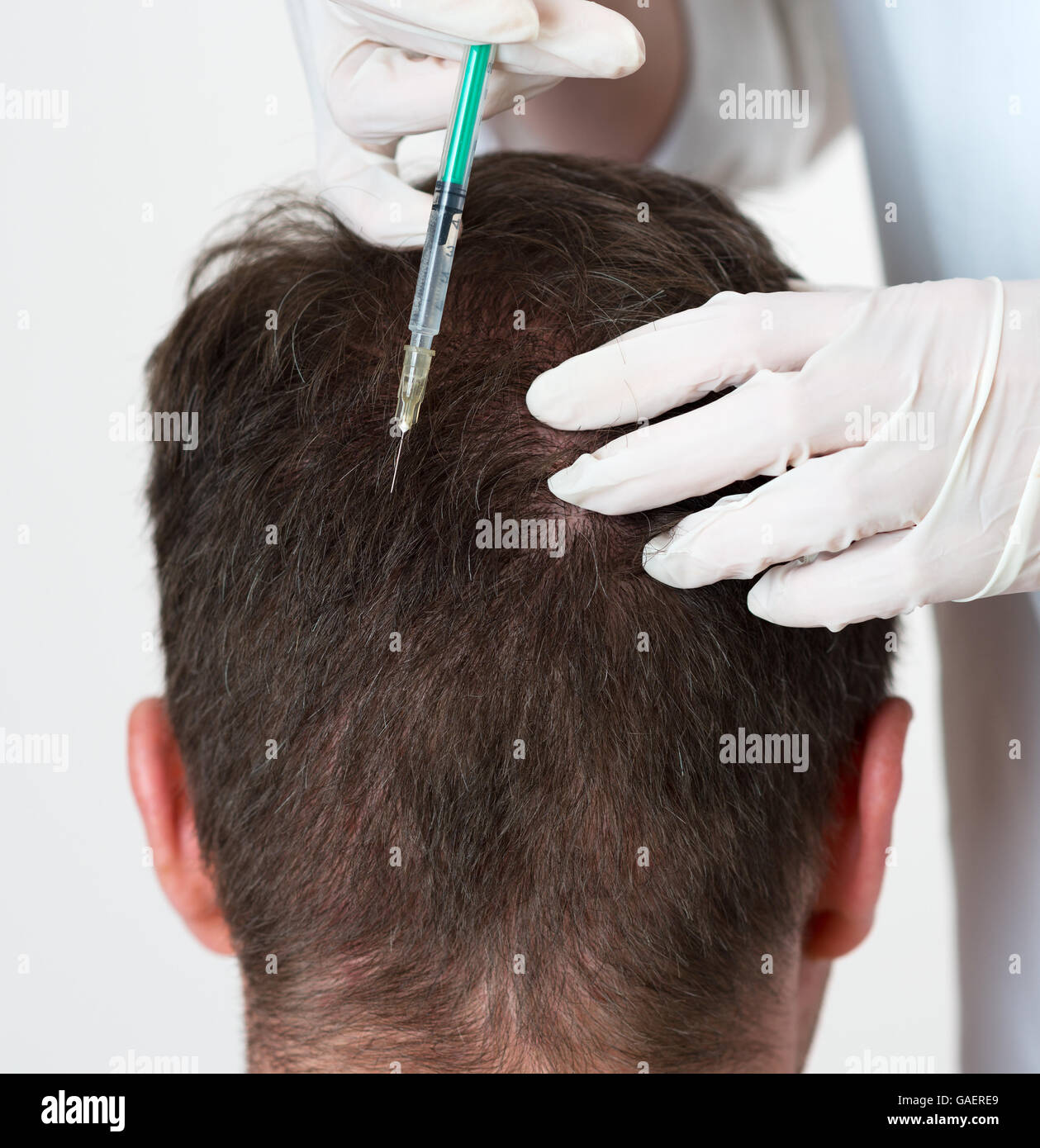 Handsome man is getting injection in head. Concept of Mesotherapy Stock ...