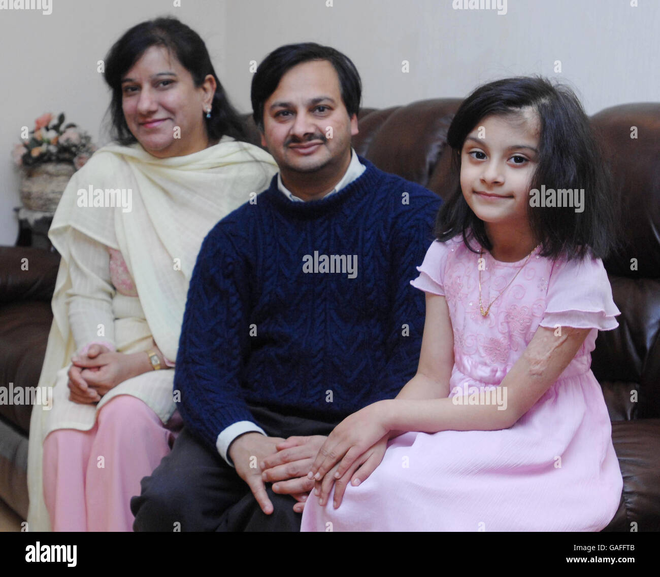 Rare treatment helps six-year-old burn victim Stock Photo - Alamy