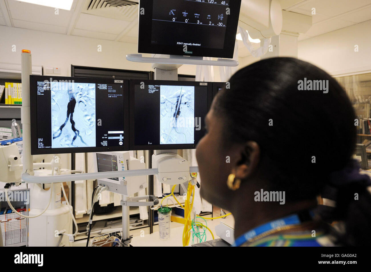 Angiography suite hi-res stock photography and images - Alamy