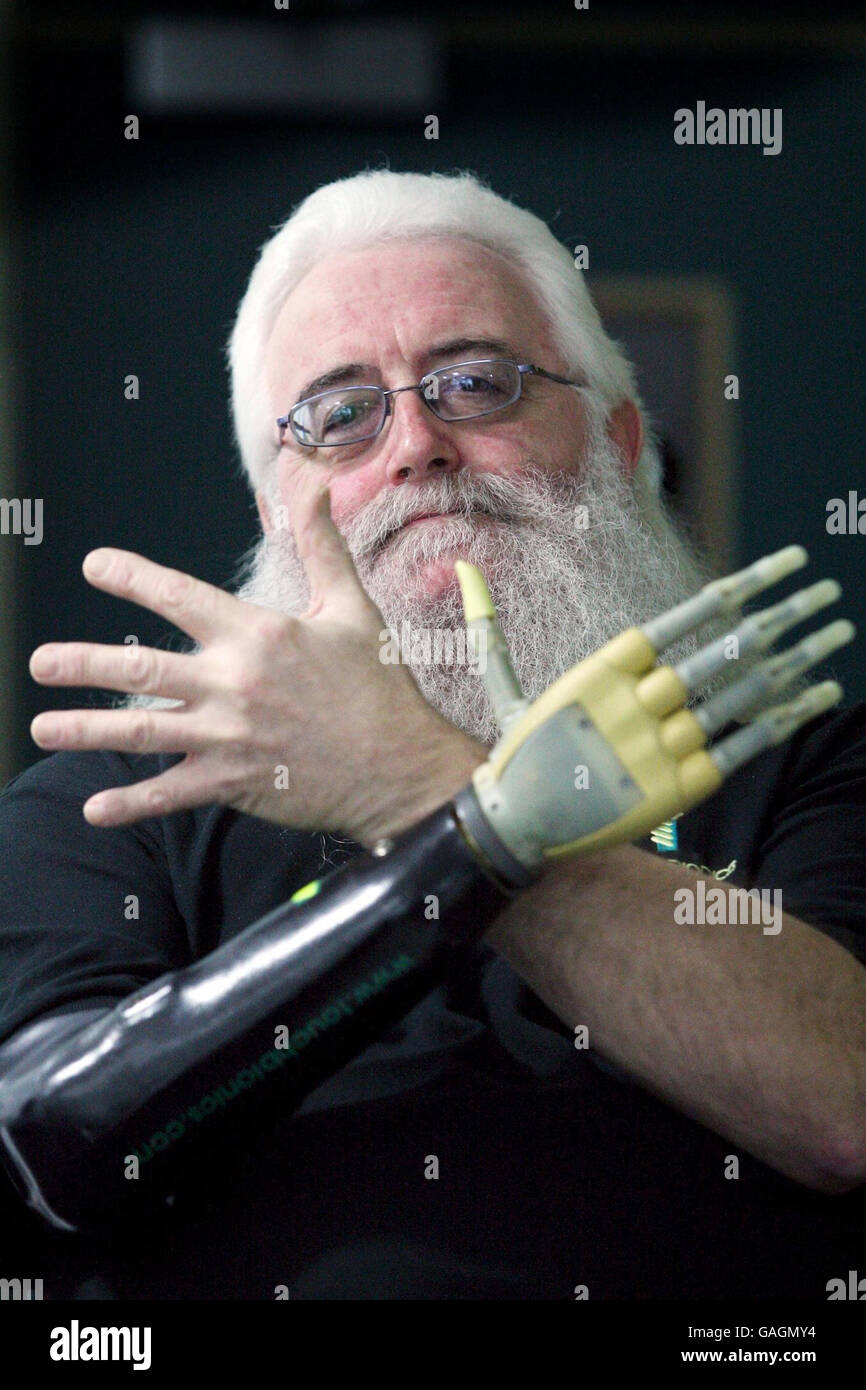 Touch bionics fingers hi-res stock photography and images - Alamy