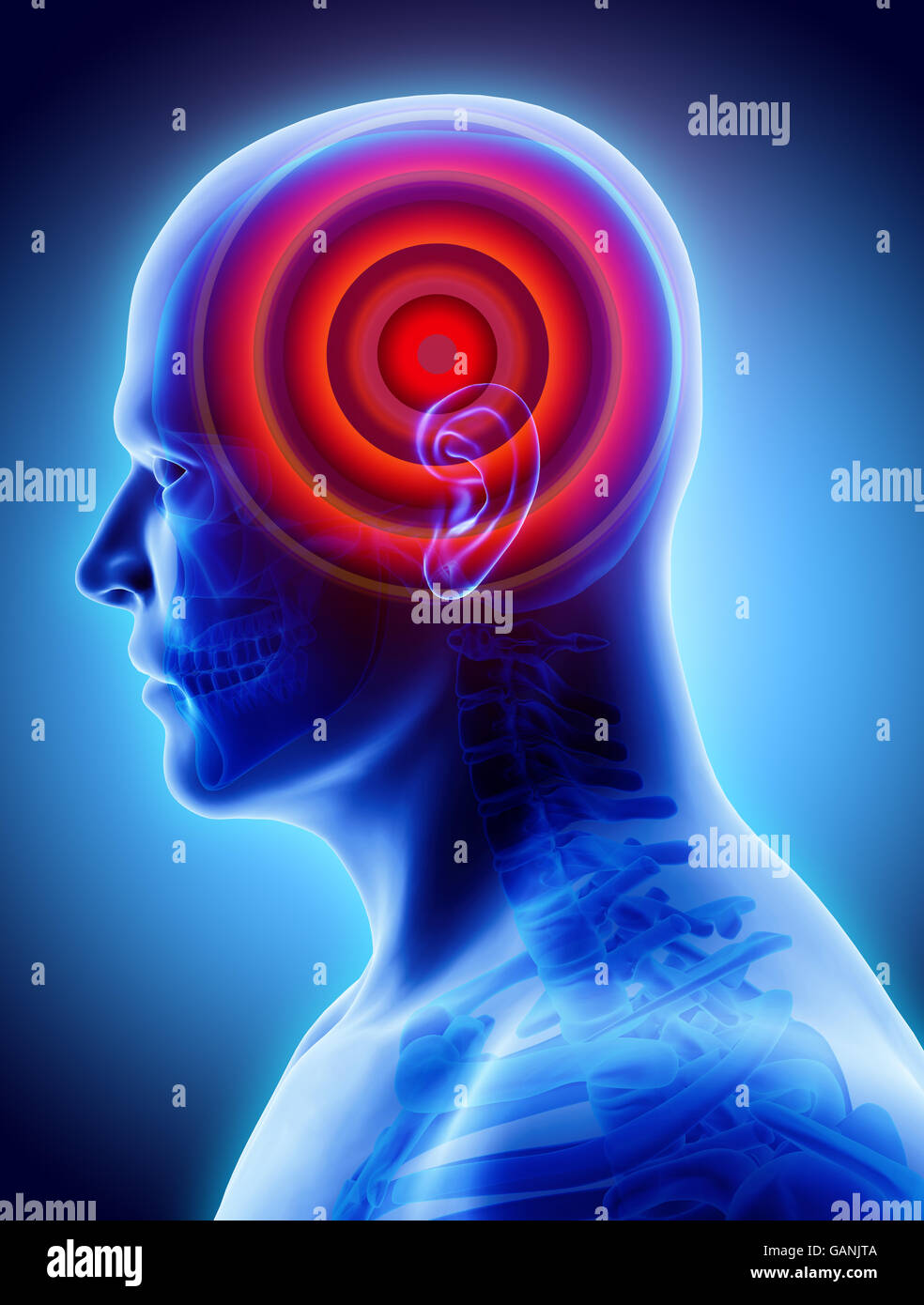 Head ache signal, 3D illustration medical concept Stock Photo - Alamy