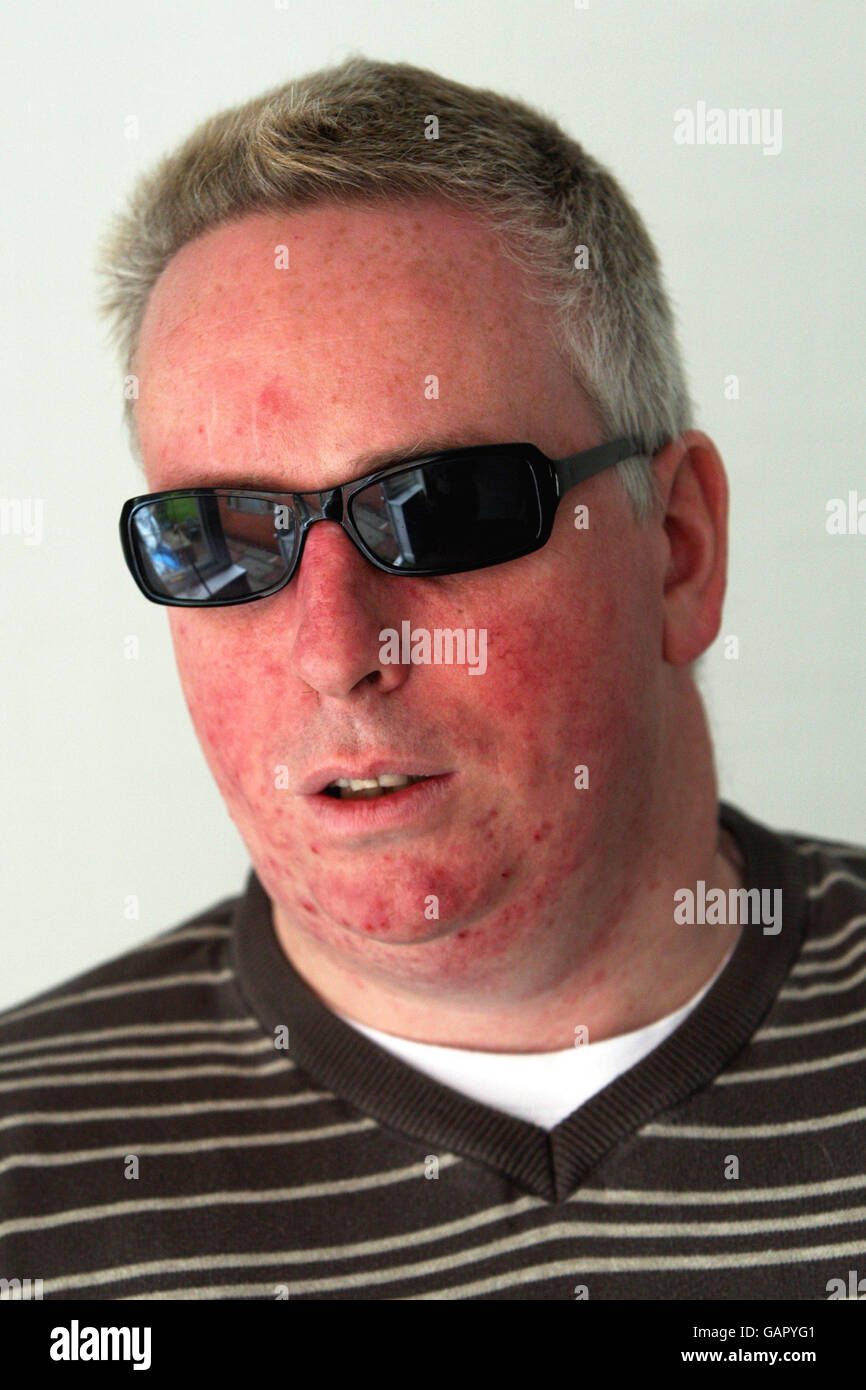Martin Conway who was mugged on his way home from Crupsall tram station ...