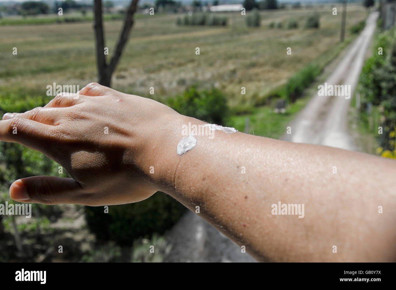 Ointment hand sting hi-res stock photography and images - Alamy