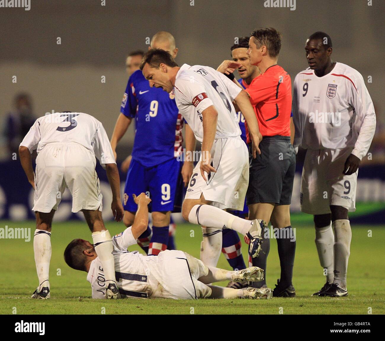 England's Joe Cole falls to the ground following an injury as he is ...