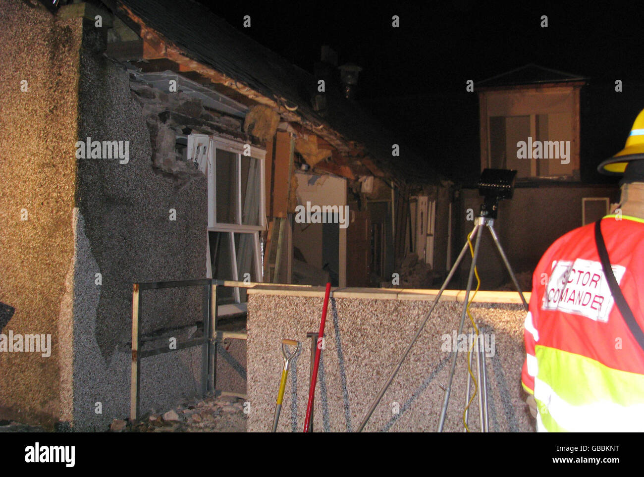 Injured arms explosion hi-res stock photography and images - Alamy