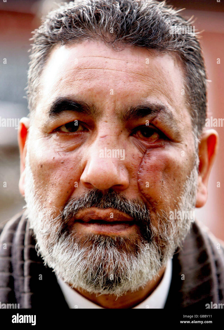 Robbers attack man with axe Stock Photo - Alamy