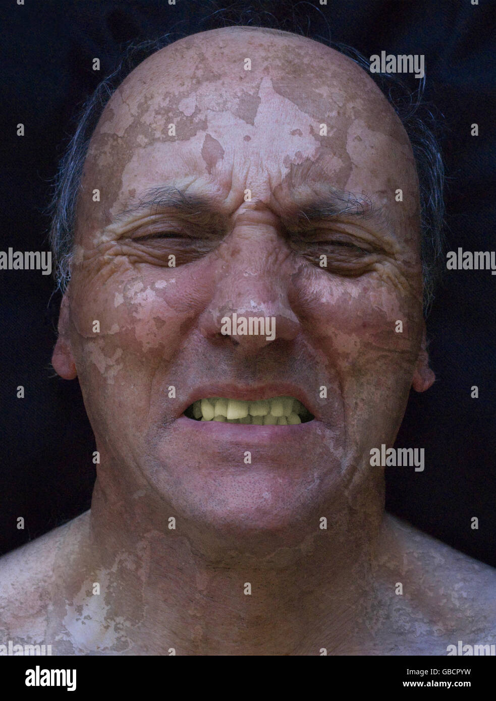 Man suffering stress and strain with a distressed expression and skin ...