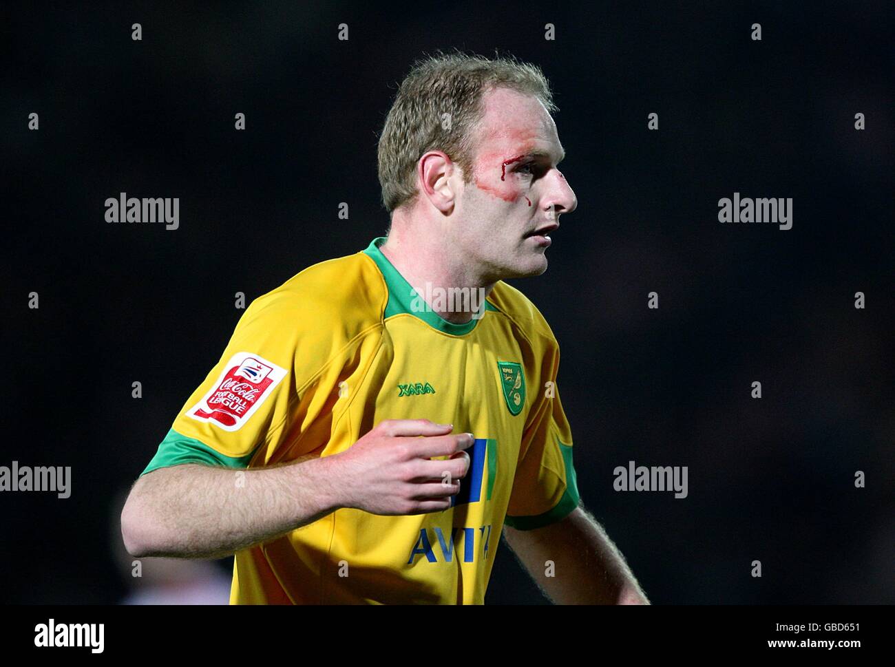 Norwich citys gary doherty after receiveing cut above his eye hi-res ...
