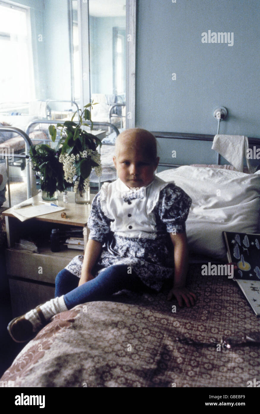 Nuclear radiation victim hi-res stock photography and images - Alamy