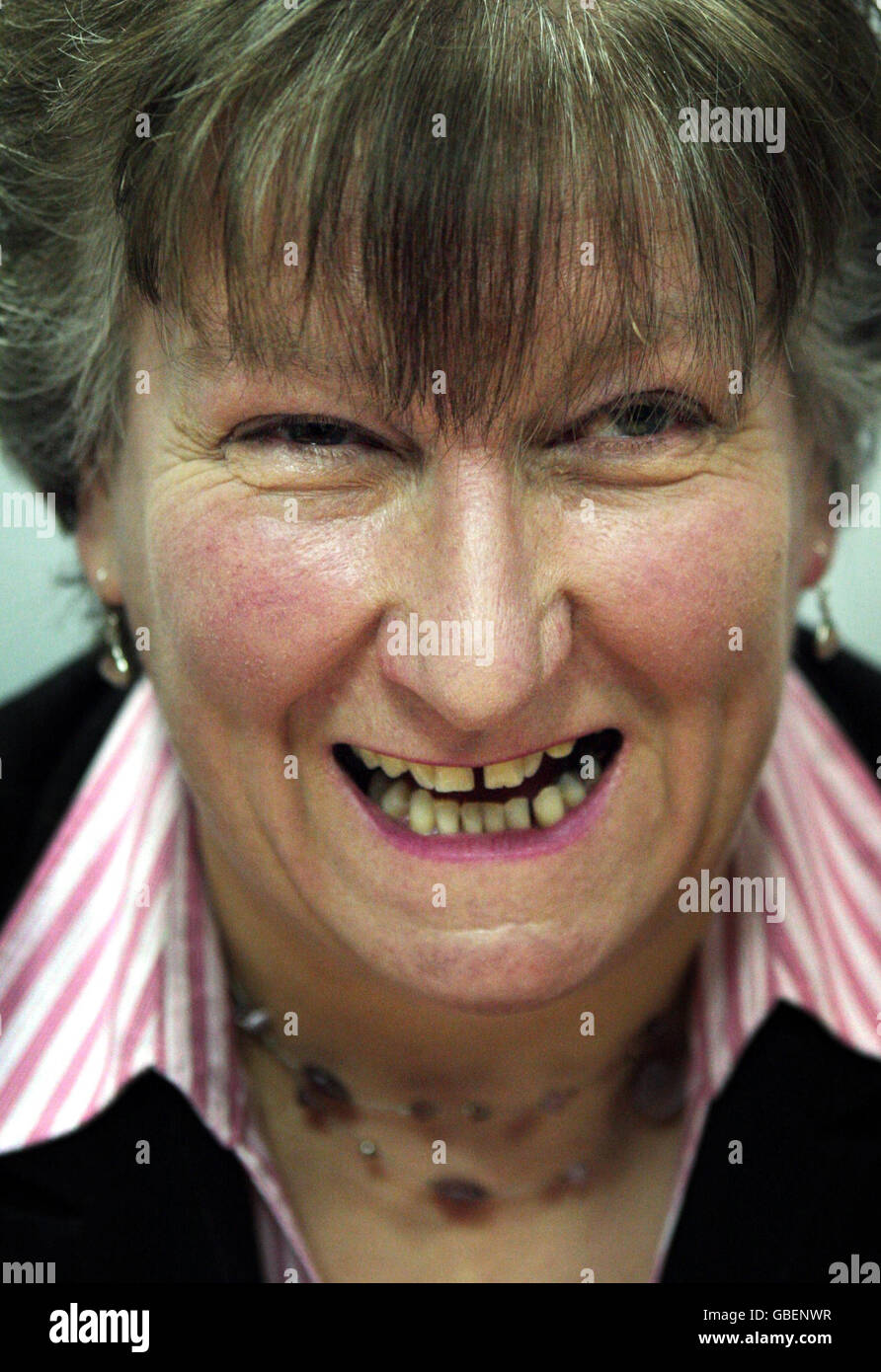 Scottish conservative press conference Stock Photo - Alamy