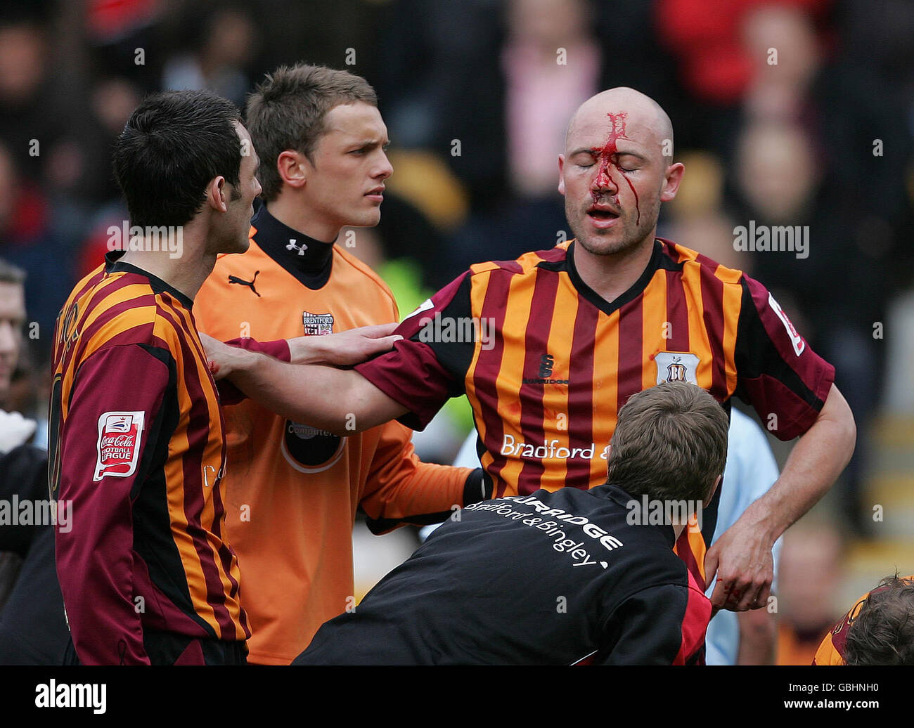 Injured bleeding football hi-res stock photography and images - Alamy