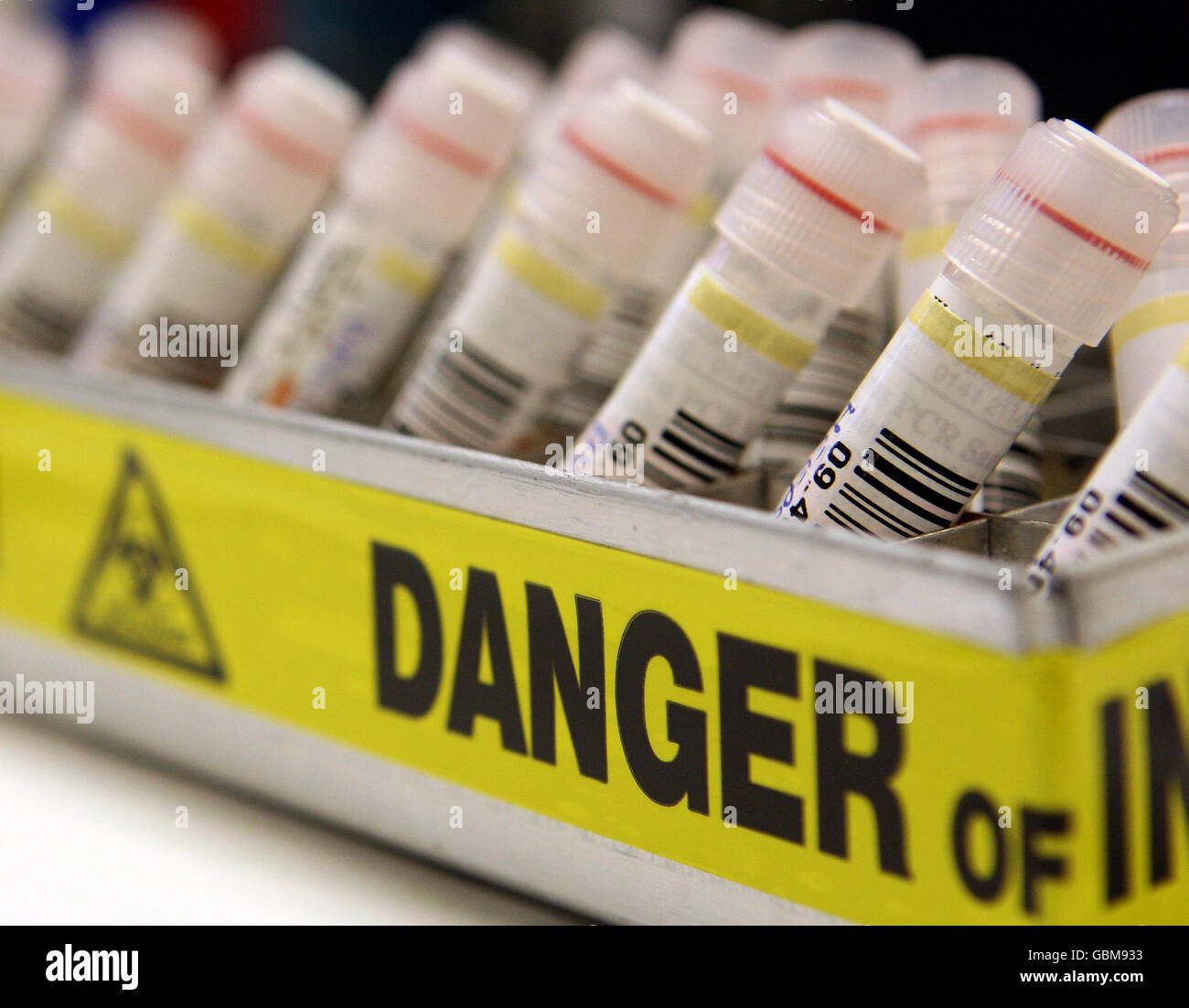 Viral samples west scotland specialist virology centre gartnavel ...