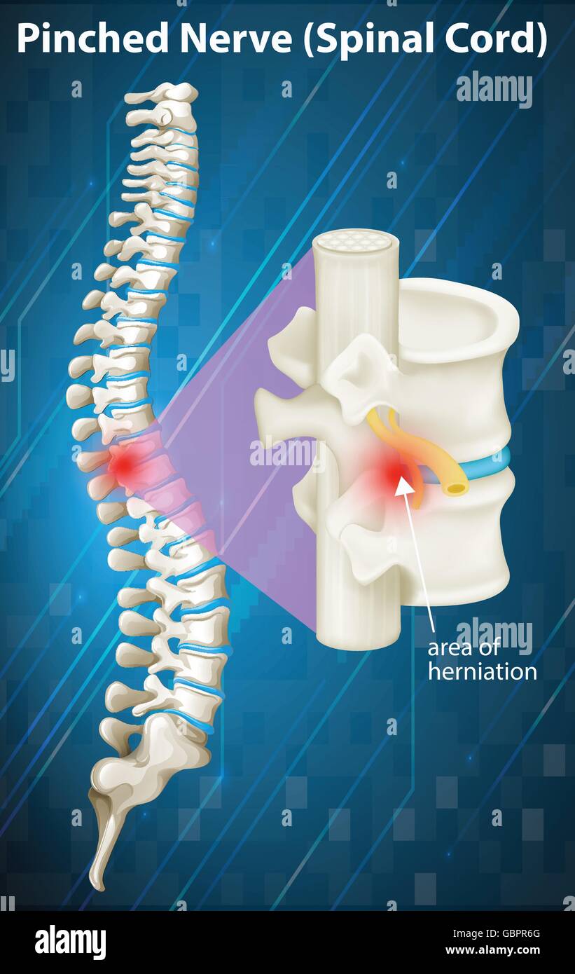 Spinal Cord Stock Photos & Spinal Cord Stock Images - Alamy