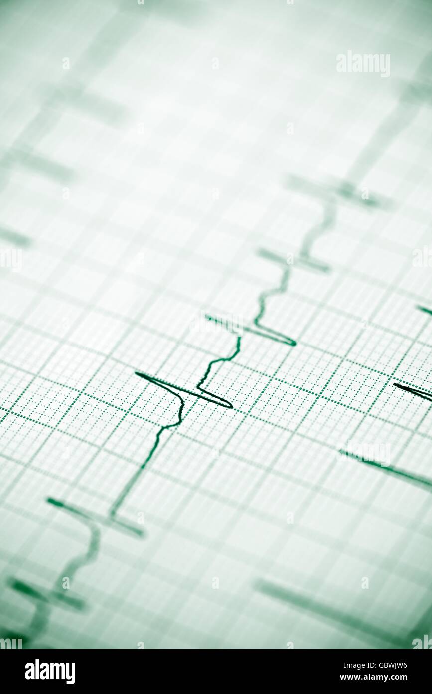 Electrocardiogram background hi-res stock photography and images - Alamy