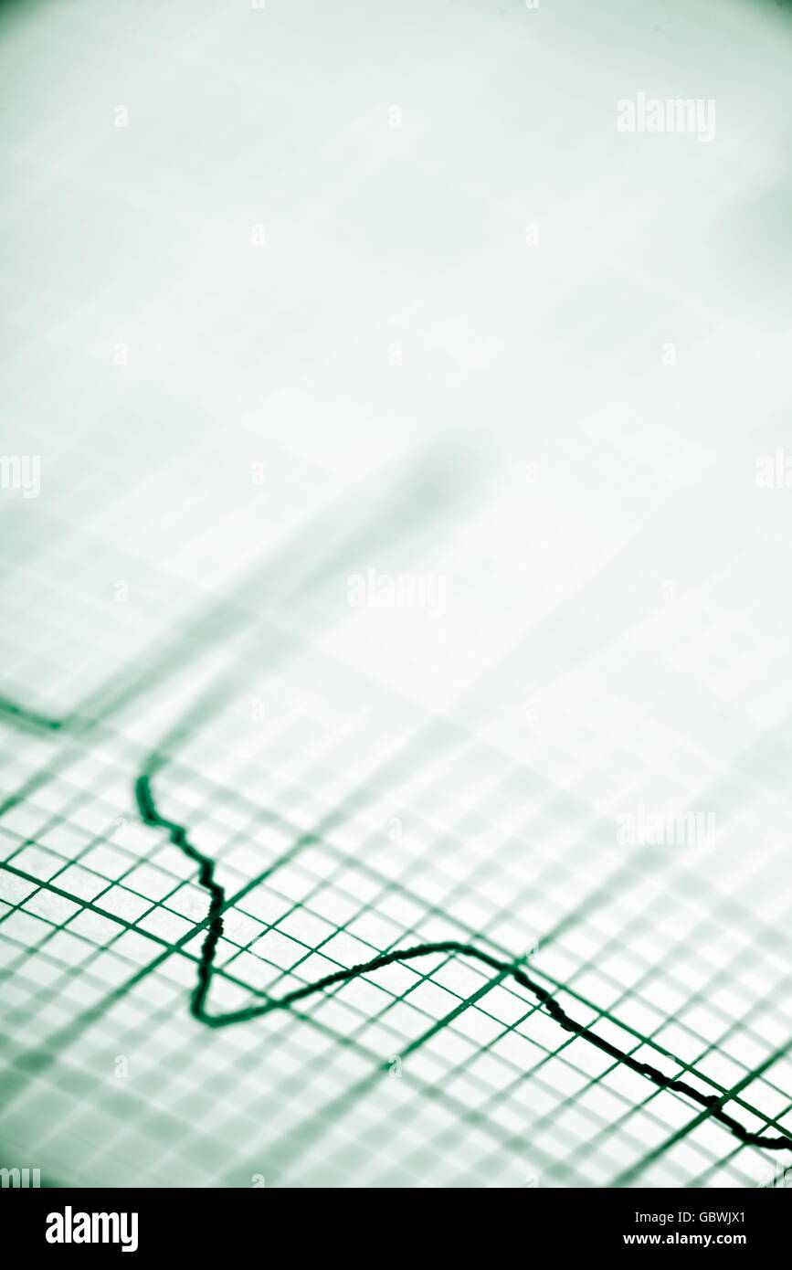 Close up of an electrocardiogram in paper form Stock Photo - Alamy