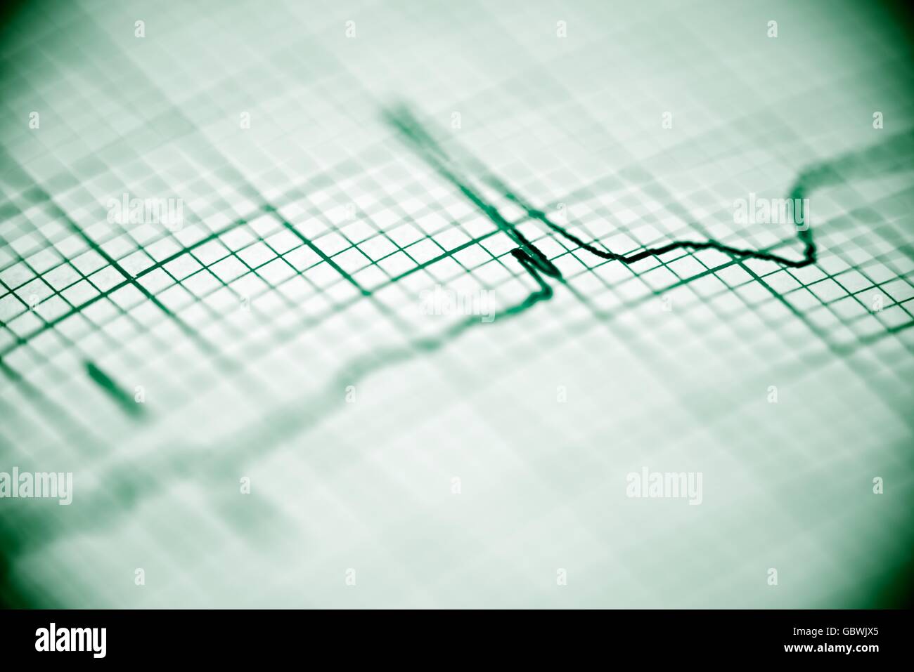 Electrocardiogram background hi-res stock photography and images - Alamy