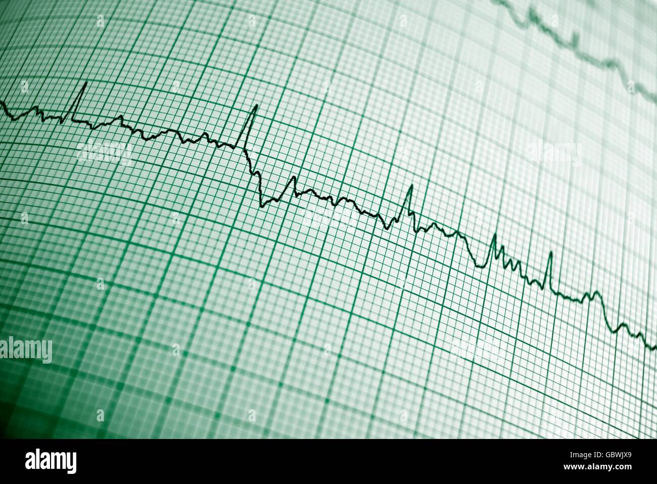 Close up of an electrocardiogram in paper form Stock Photo - Alamy