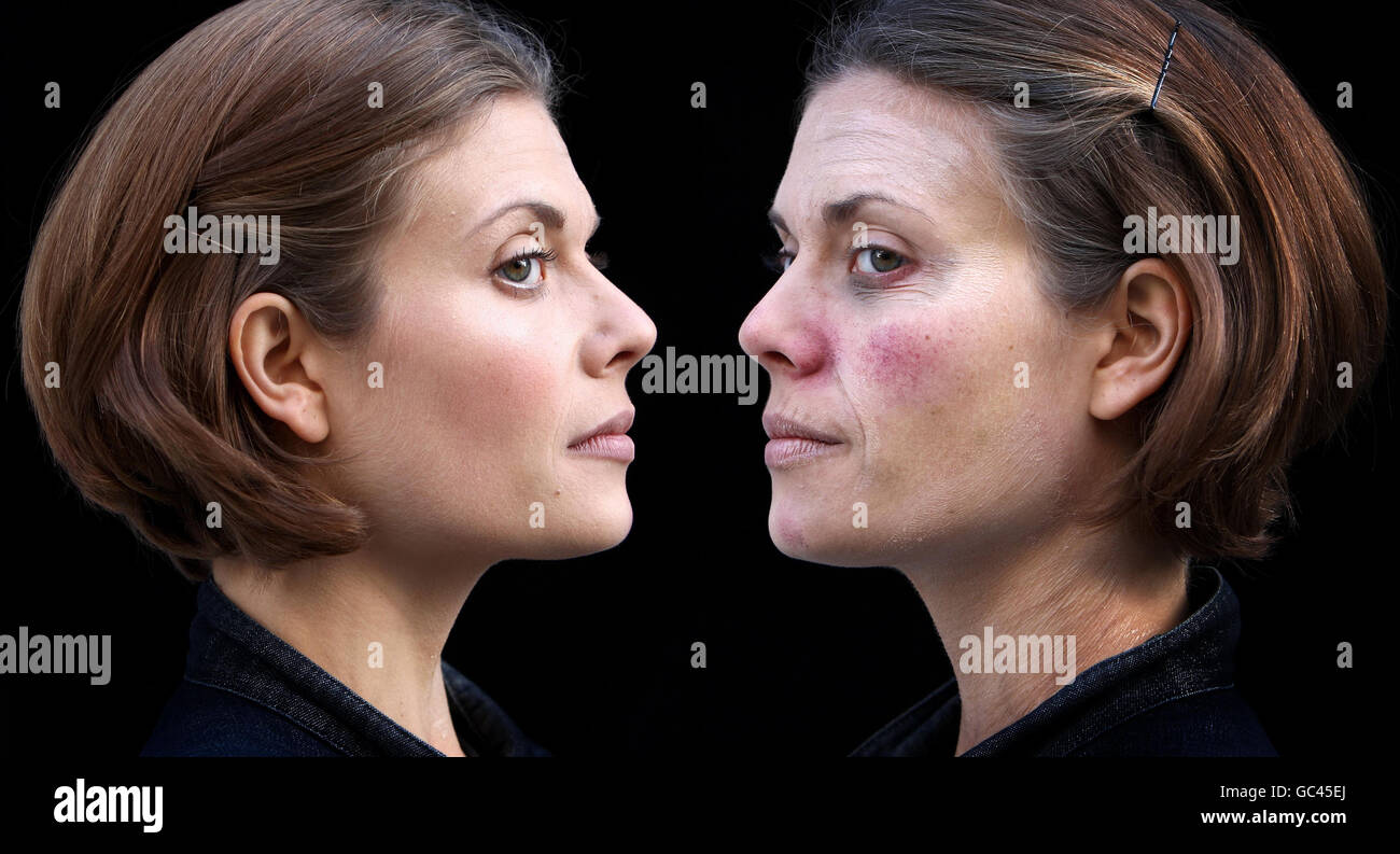 Effects of excessive alcohol consumption Stock Photo - Alamy