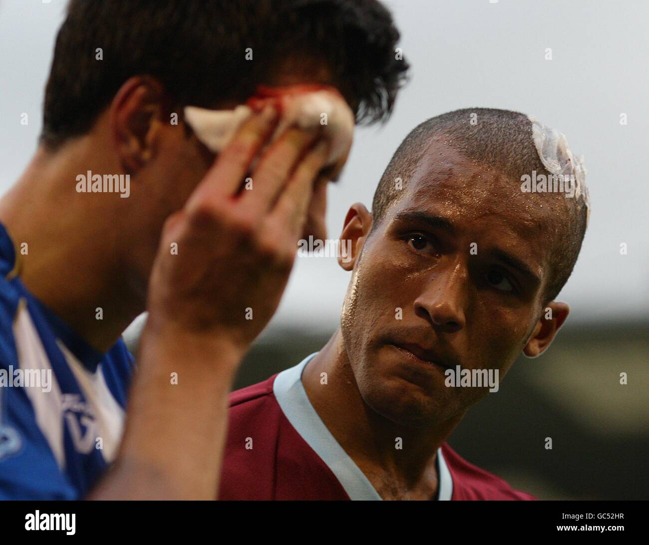 Soccer Football Blood Bleeding High Resolution Stock Photography and ...