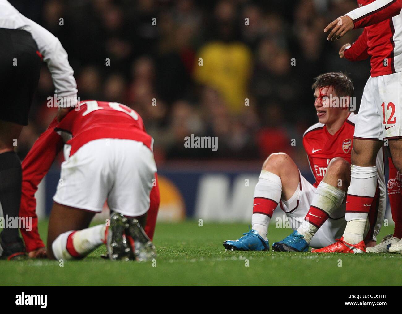 Soccer football blood bleeding hi-res stock photography and images - Alamy