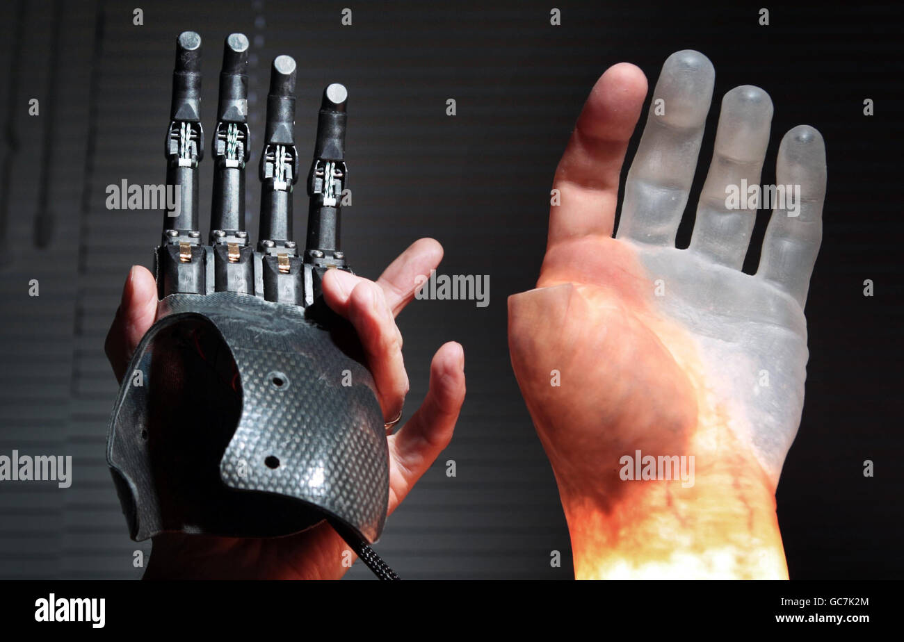 Prosthetic hand fingers hi-res stock photography and images - Alamy