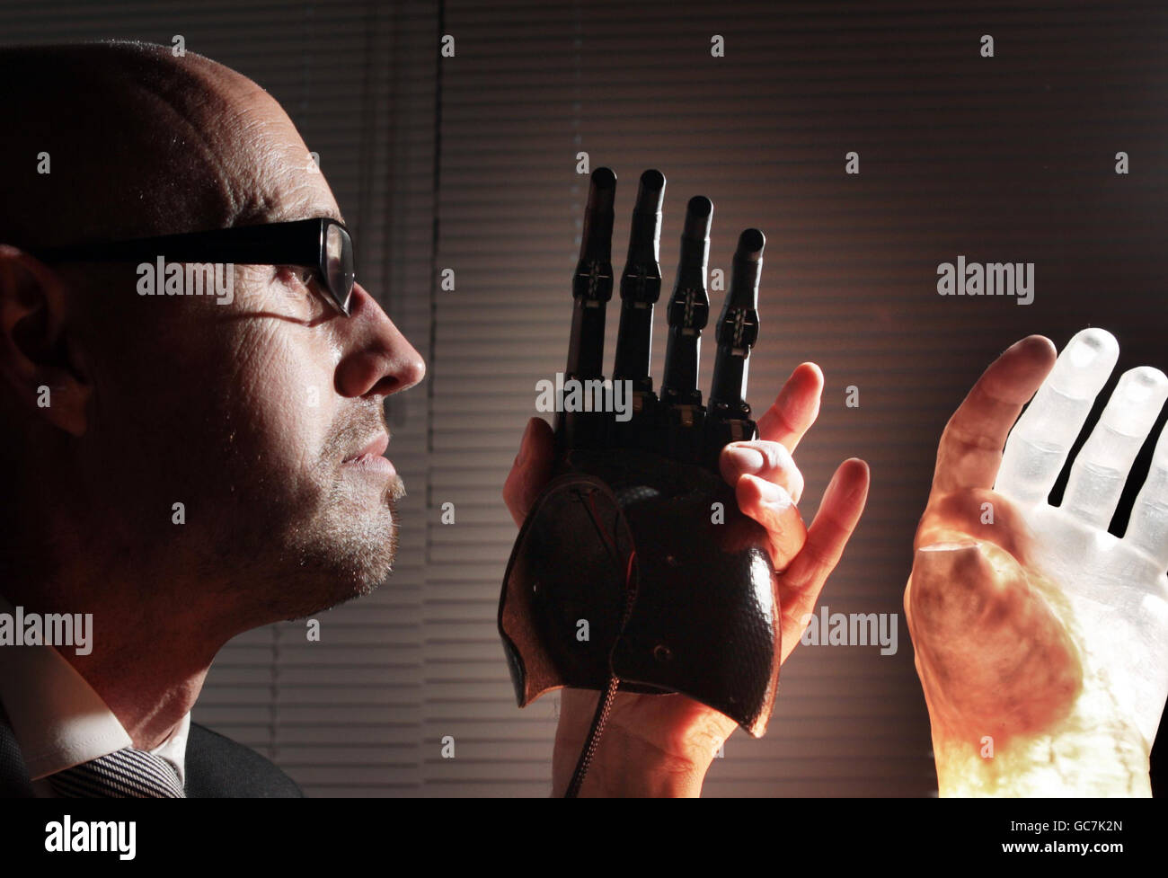World’s first bionic fingers Stock Photo - Alamy