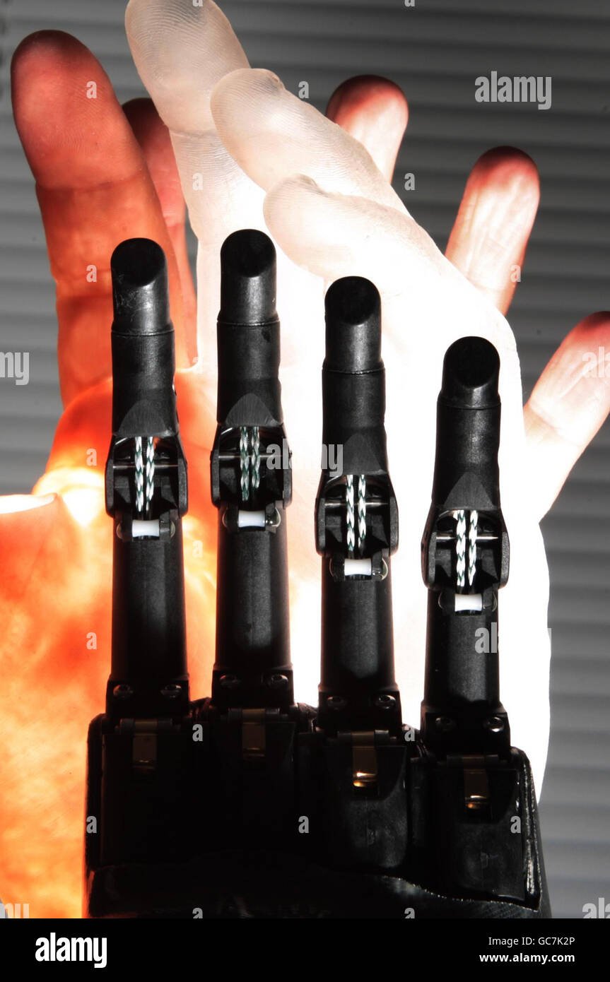 Scientists today unveiled what they claim are the world's first bionic ...