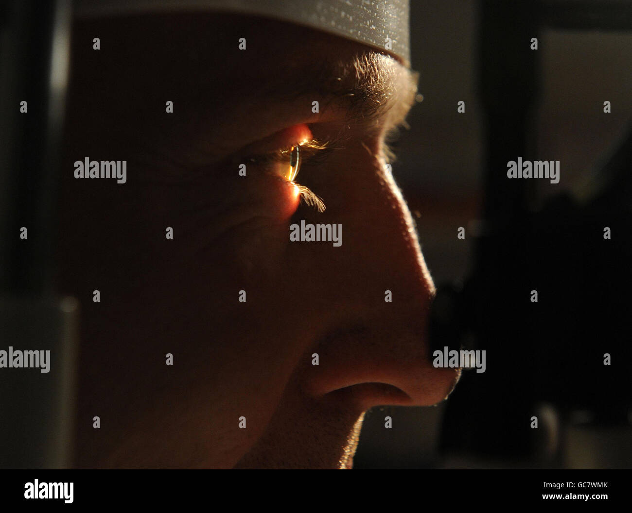 A close up of the eye of patient Russell Turnbull at the RVI hospital ...