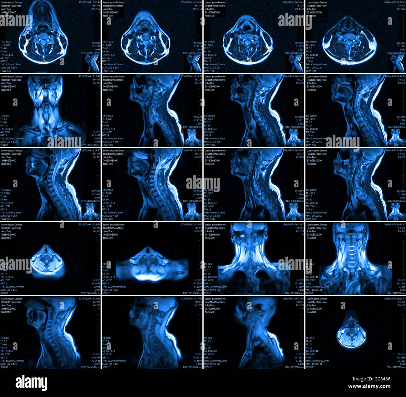 Ct scan neck head hi-res stock photography and images - Alamy