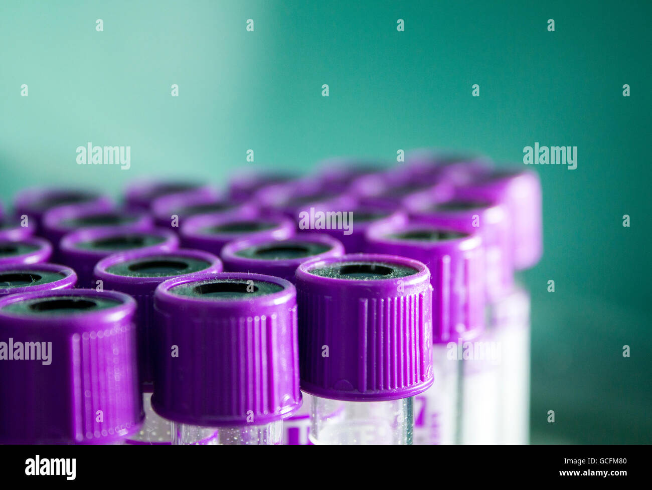 Vials of blood tests hi-res stock photography and images - Alamy