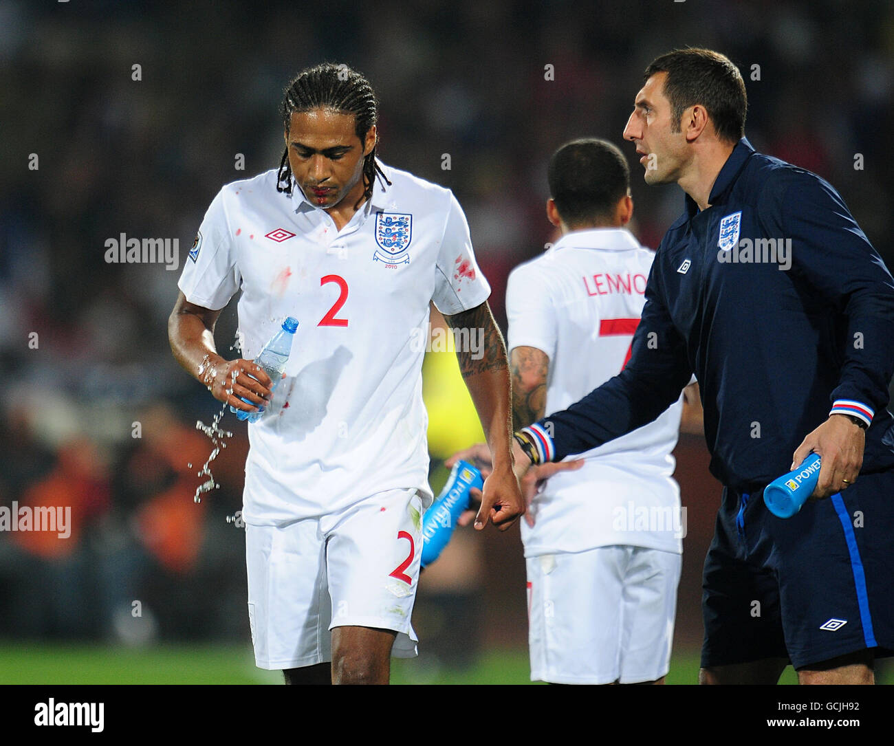 Englands glen johnson out his mouth after getting bloody lip hi-res ...