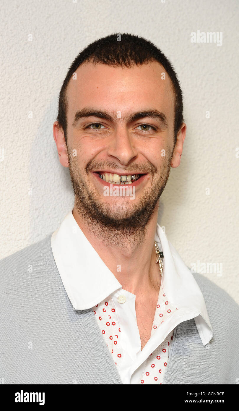 Joseph Gilgun Teeth