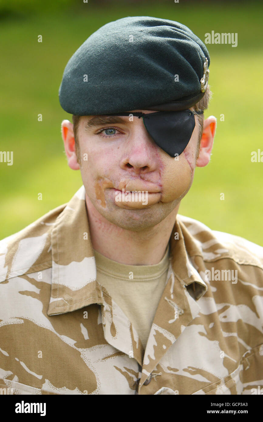 Corporal Ricky Furgusson, 24, from Telford, who serves with the 4th ...