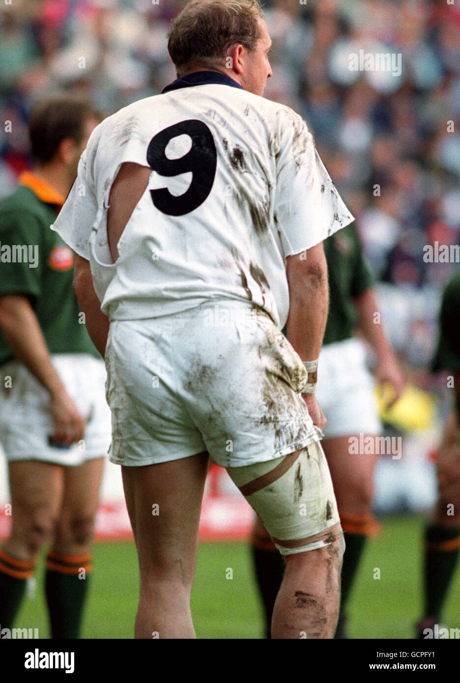 DEWI MORRIS, ENGLAND, SHOWING OF HIS `BATTLE SCARS' AFTER MATCH AGAINST ...