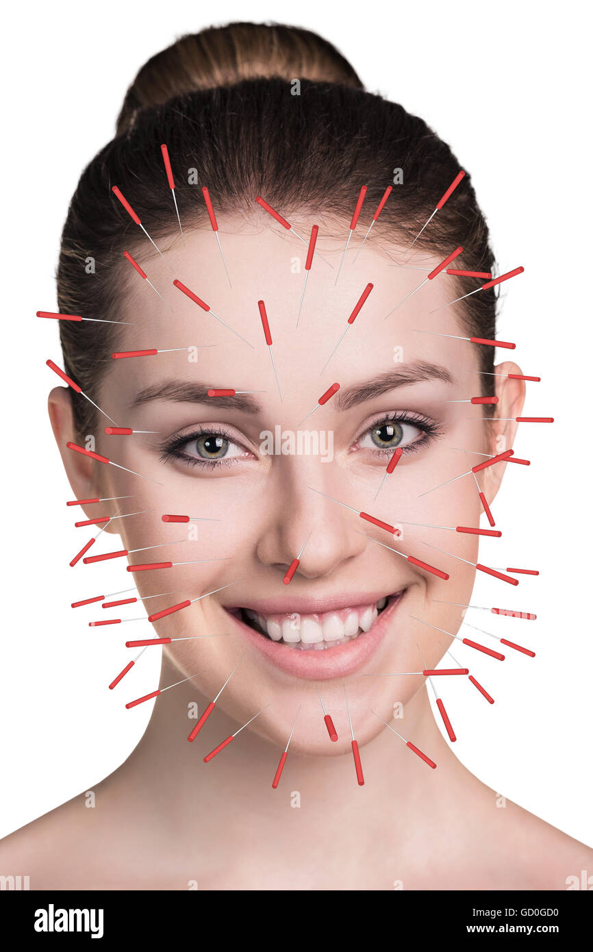 Close-up of performing acupuncture therapy on face Stock Photo - Alamy