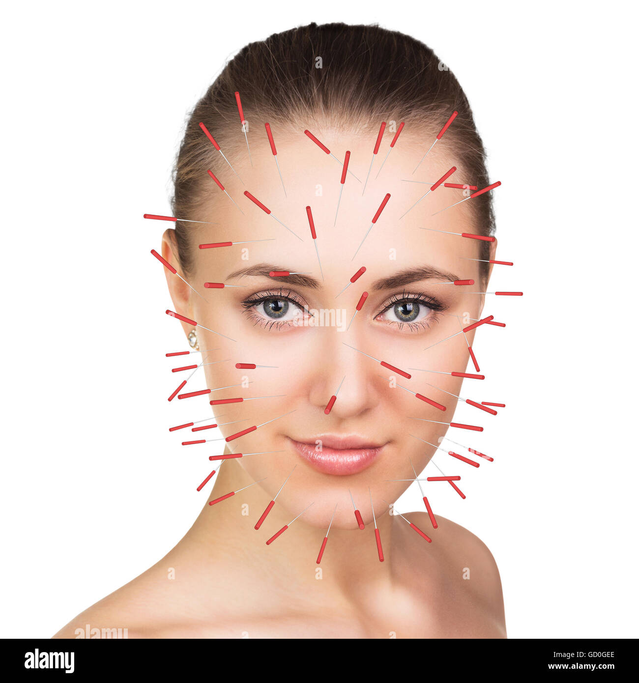 Acupuncture woman smile hi-res stock photography and images - Alamy