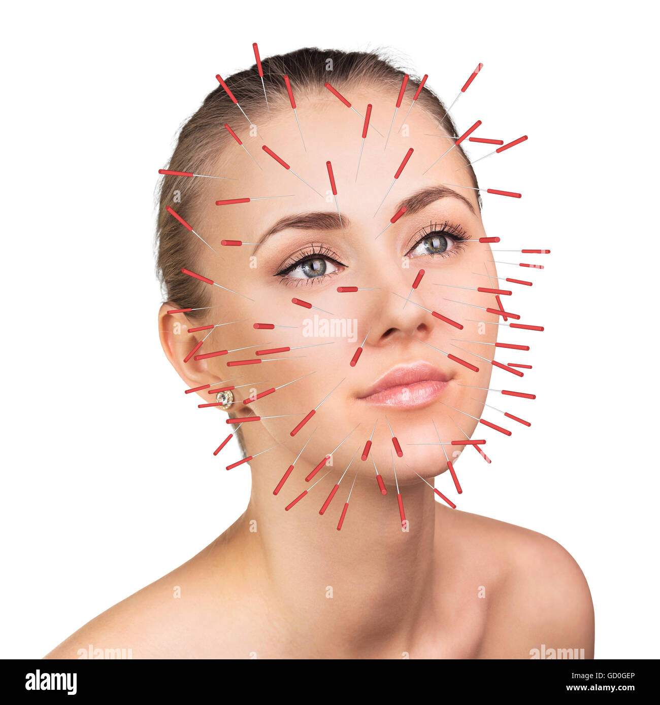 Acupuncture woman smile hi-res stock photography and images - Alamy