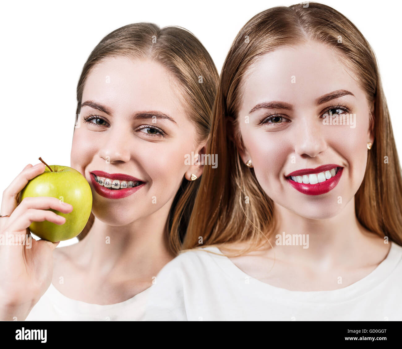 Young woman with brackets on teeth eating apple Stock Photo - Alamy