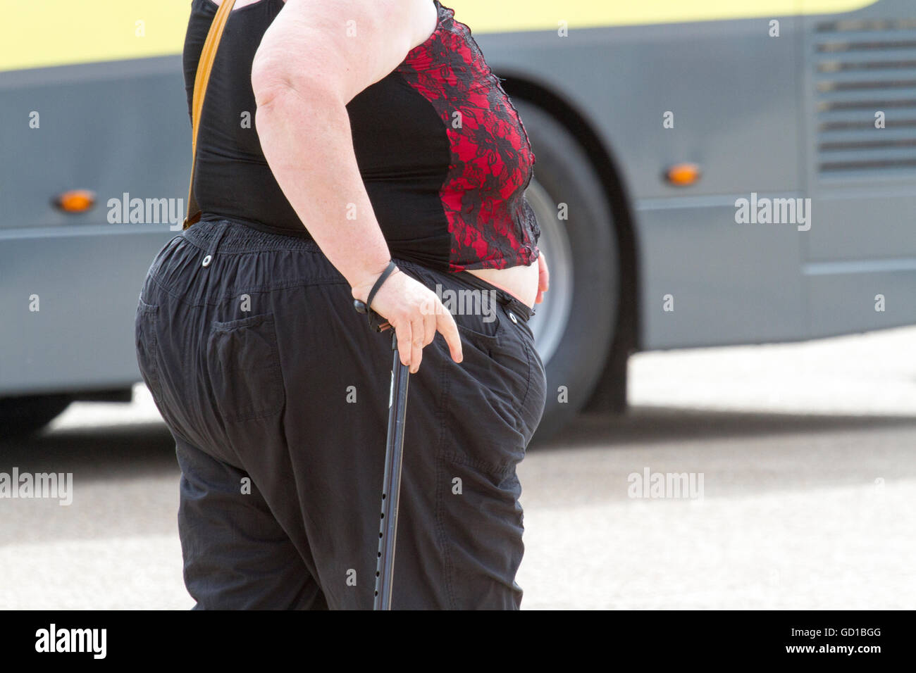 An obese woman, bloated bellies, stomach fat, overweight with distended ...