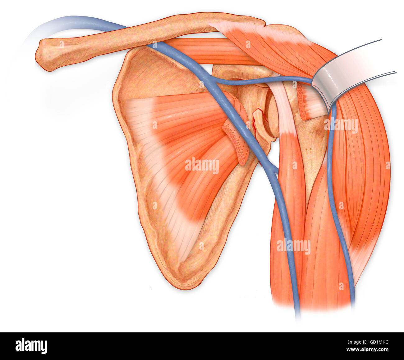 Shoulder muscle surgery hi-res stock photography and images - Alamy