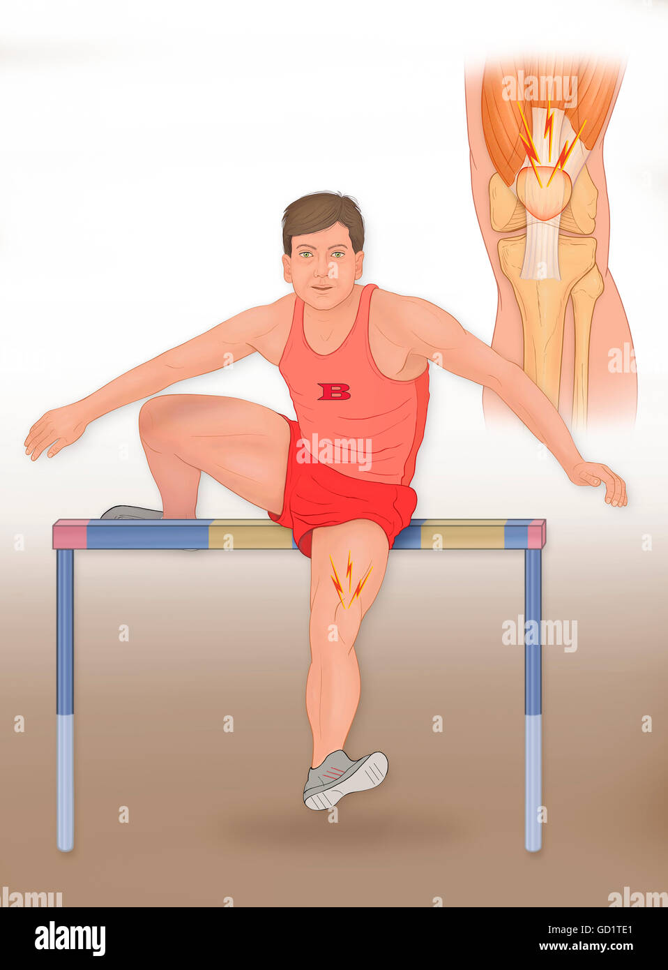 Knee diagram hi-res stock photography and images - Alamy