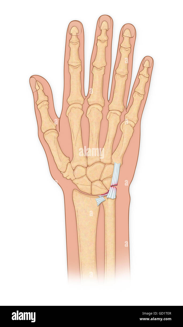 Hand bones hi-res stock photography and images - Alamy