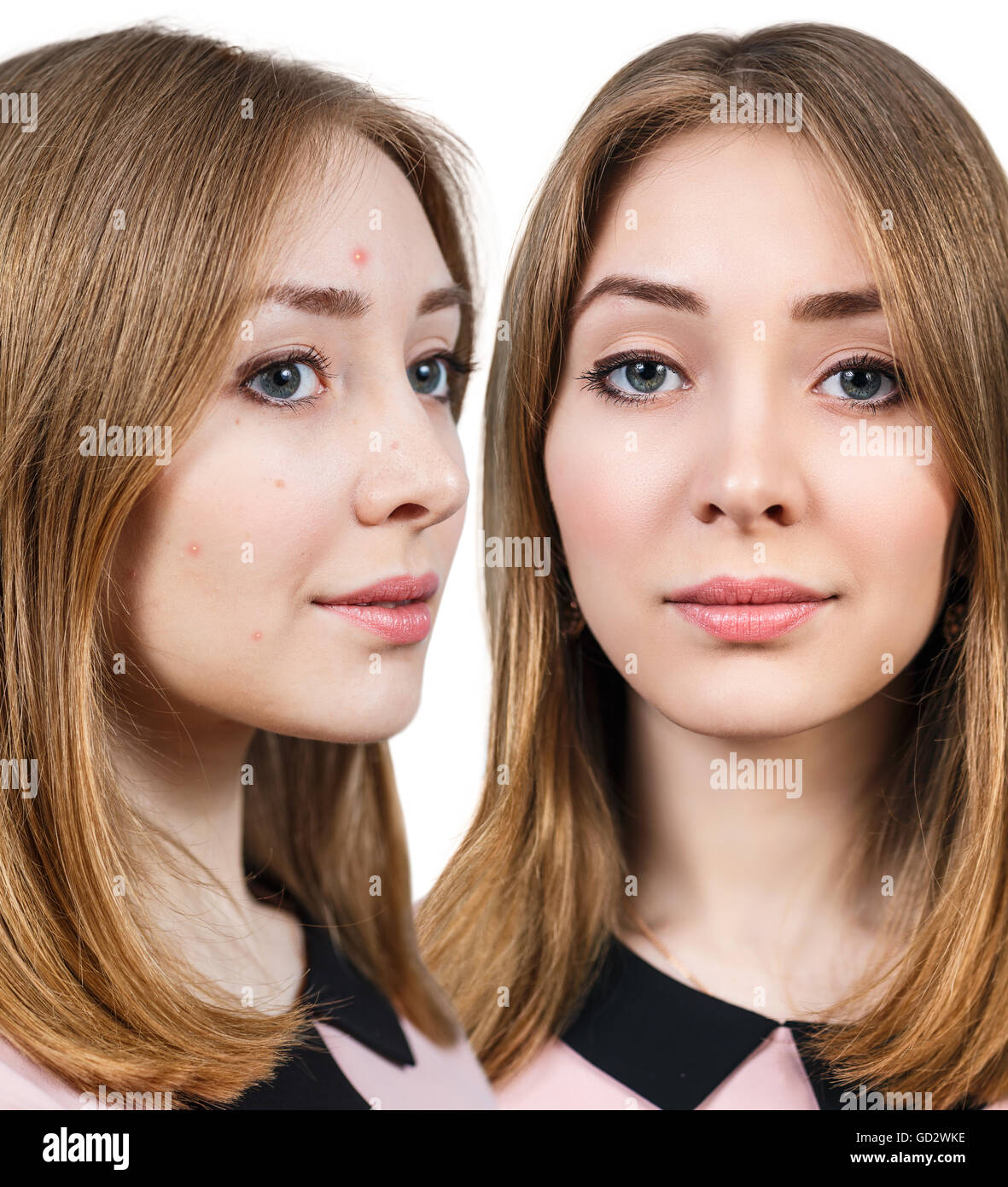Skin dermatology hi-res stock photography and images - Alamy