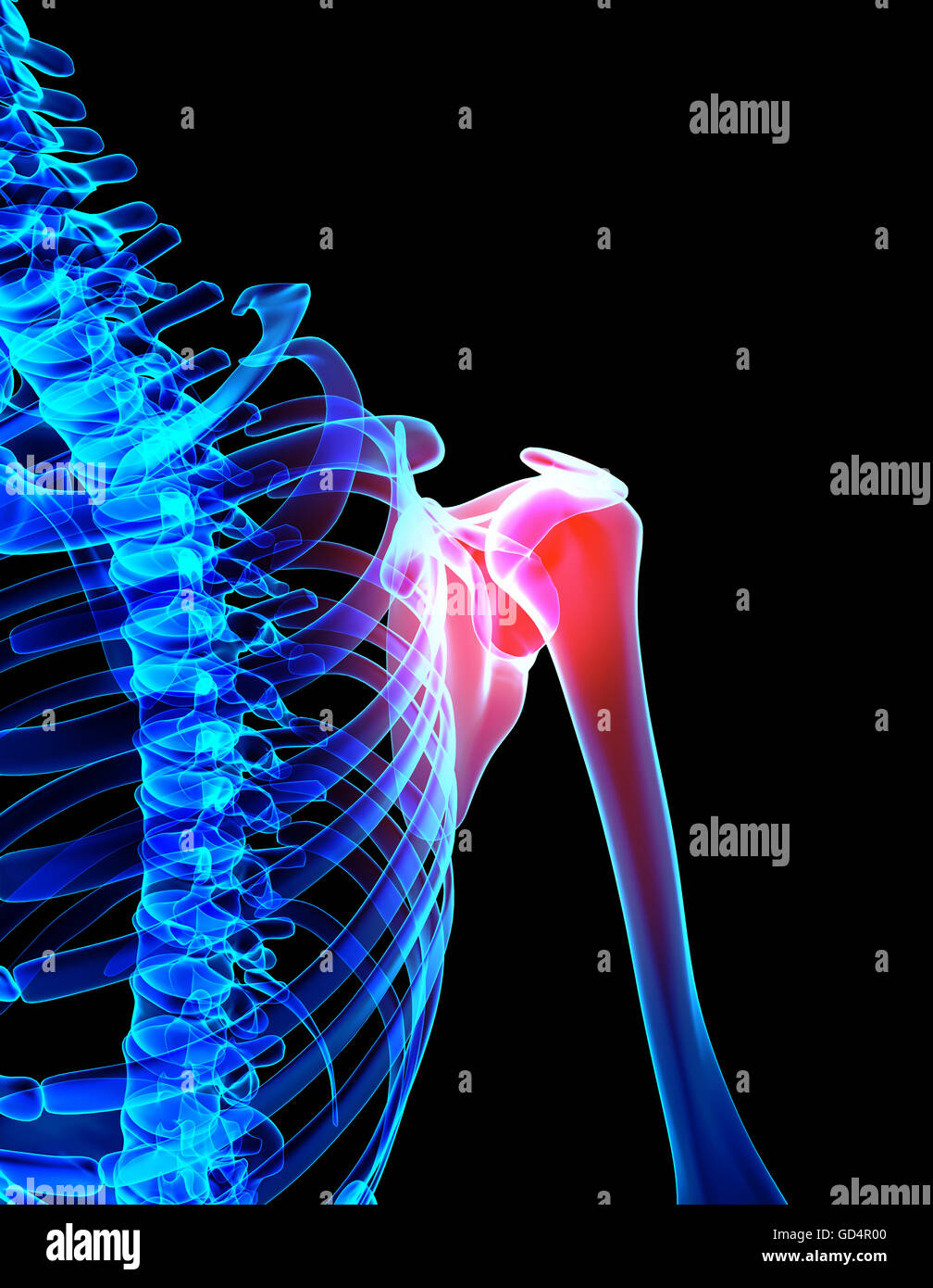 Shoulder painful skeleton hi-res stock photography and images - Alamy