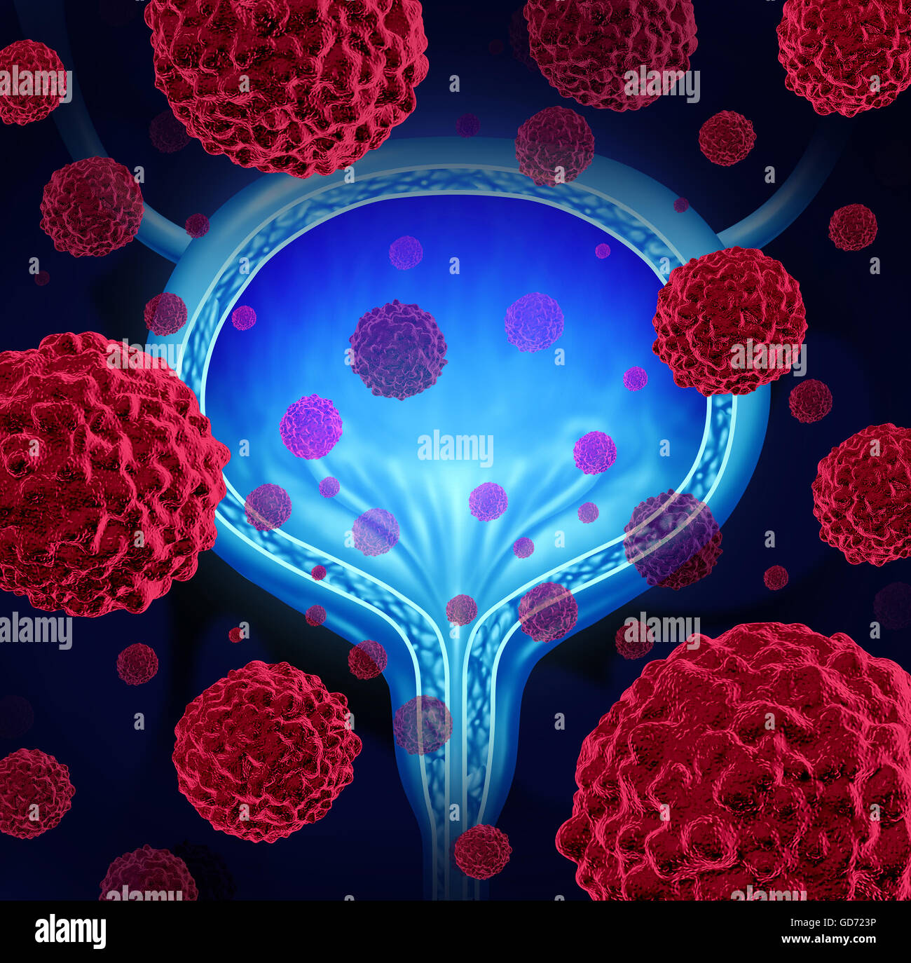 Bladder Cancer High Resolution Stock Photography and Images - Alamy