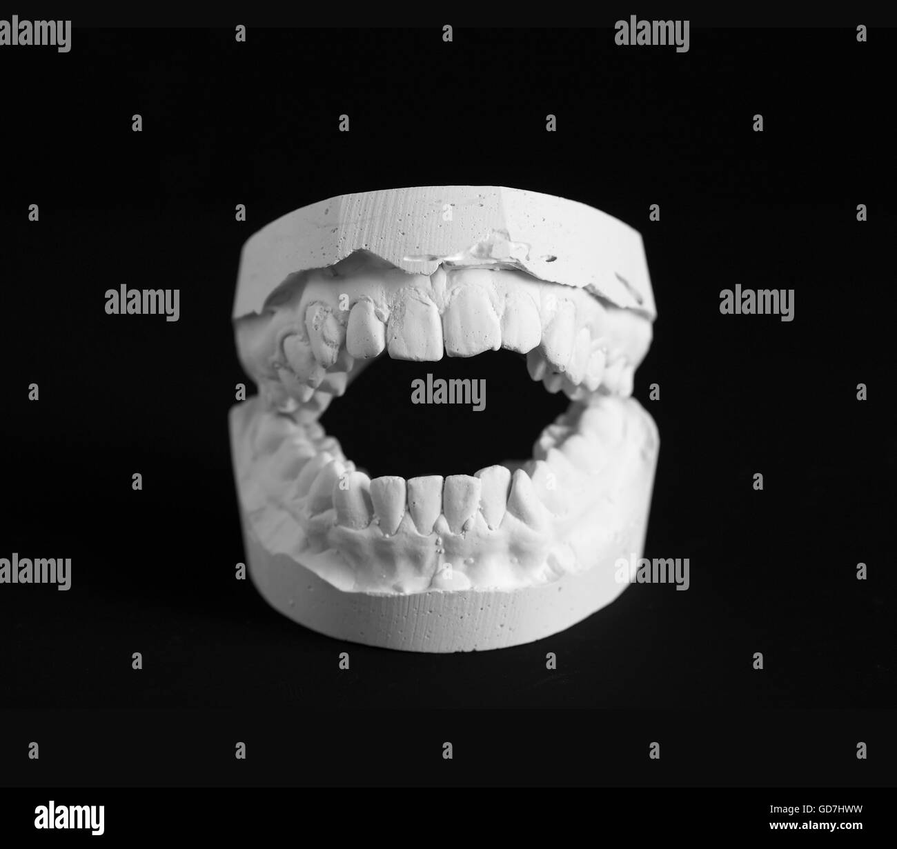 Teeth mold hi-res stock photography and images - Alamy