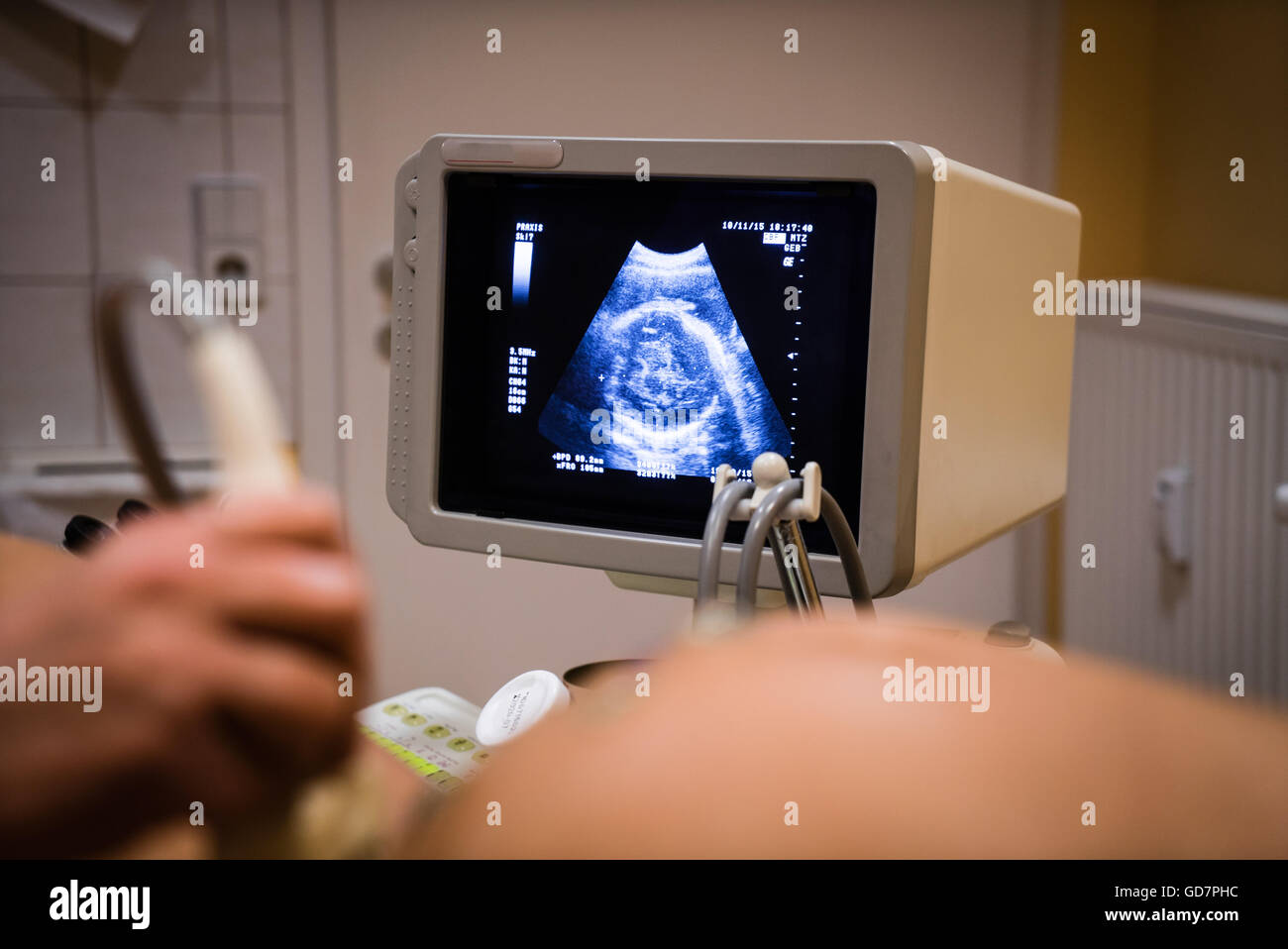 ultrasound image of a 30 week old fetus Stock Photo - Alamy