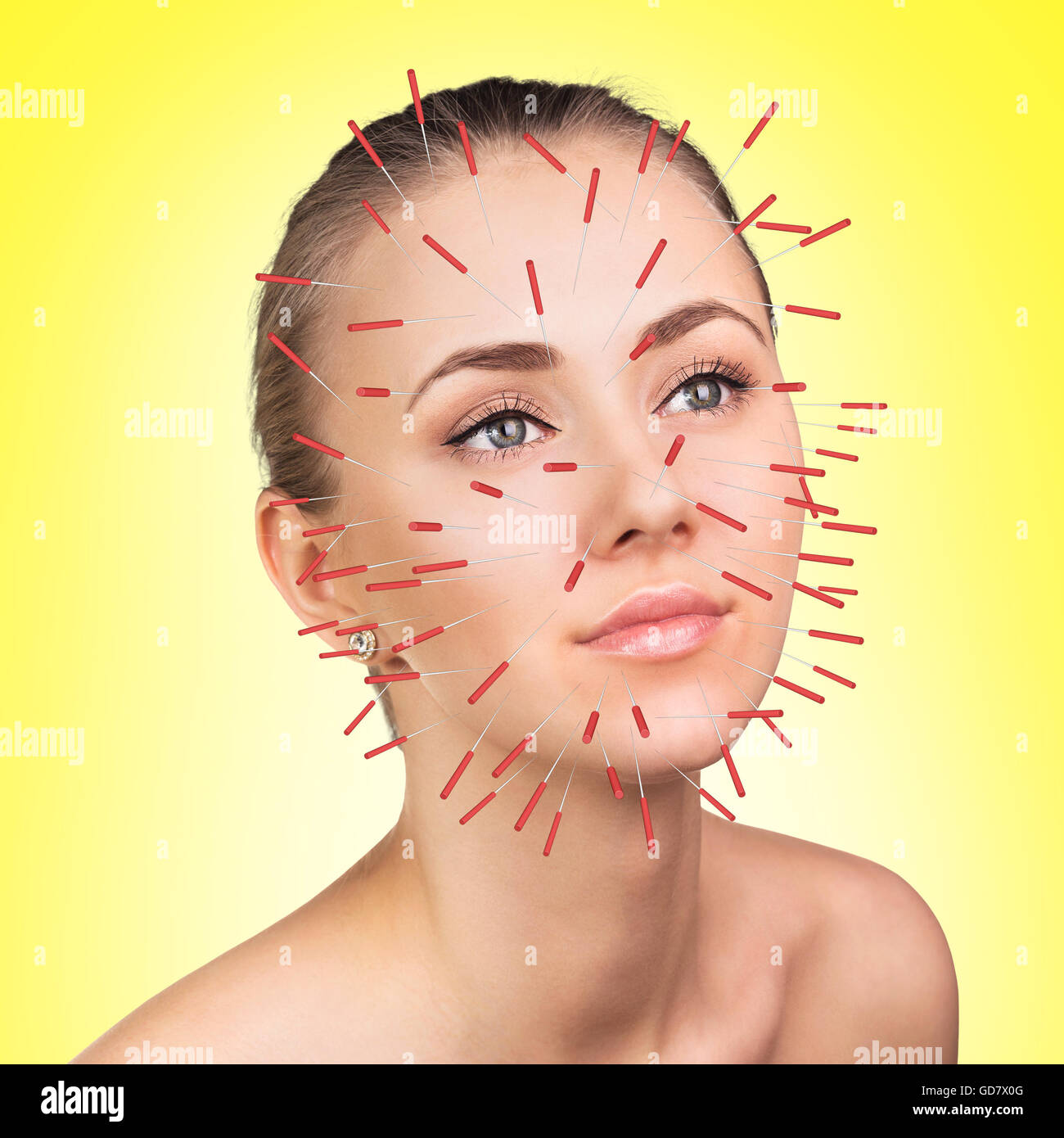 Close-up of performing acupuncture therapy on face Stock Photo - Alamy